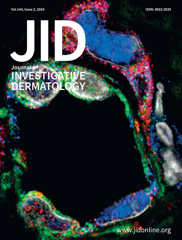 Journal of Investigative Dermatology | Elsevier Pharma Solutions